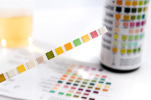 Ketone Test Strips: How to Use and Read Them Properly